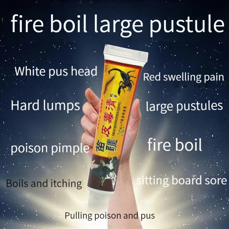 [SG stocks]Fire boil poison cream hard lump abscess pimple redness ...