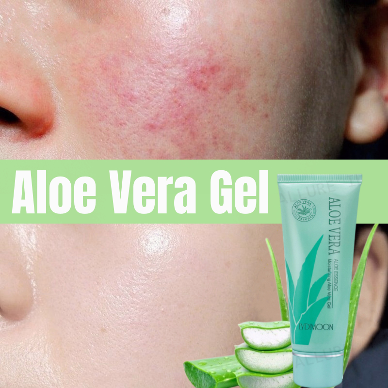 Aloe Vera Gel Soothing Natural Moisturizing Hydrating Remove Acne Marks ...
