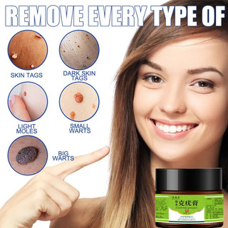 Wart Removal Cream Painless Ointment Papilloma Acne Mole 20g Mole and ...