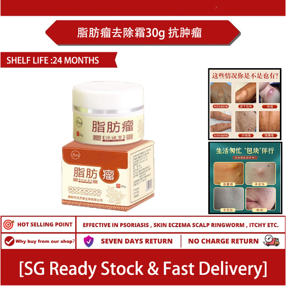 脂肪瘤软膏Lipoma Cream 30g Ointment Fat Granule Care Lipoma Subcutaneous ...