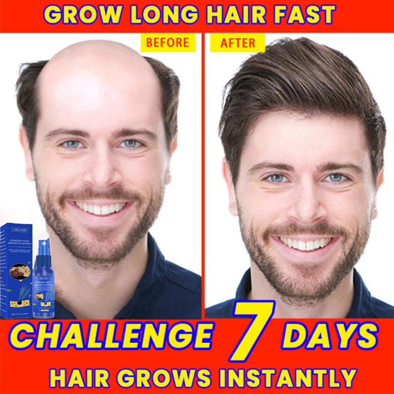 Powerful Ginger Hair Growth Serum Spray Anti Hairs Loss Treatment