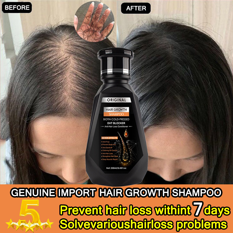 ⚡Ginger Hair Growth Shampoo⚡Anti-Hair Loss 7 Day Fast Promotes Hair ...