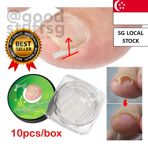 [SG FREE 🚚] 10Pcs Professional Ingrown Toenail Correction Tool ...