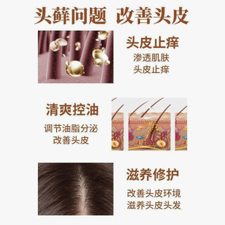 Tinea capitis, psoriasis, seborrheic dermatitis, scalp psoriasis ...