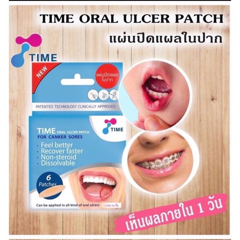 [SG 🇸🇬INSTOCKS , SHIP WITHIN 24 HOURS] Time Oral Ulcer Patch / Mouth ...