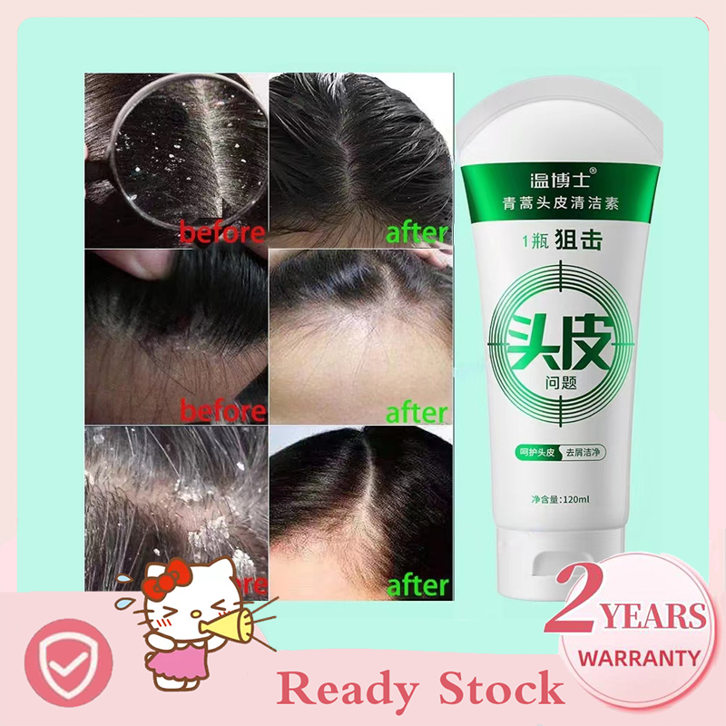 120ML Scalp Cleansing Shampoo Anti Dandruff Remove Mite Hair Fall Anti ...