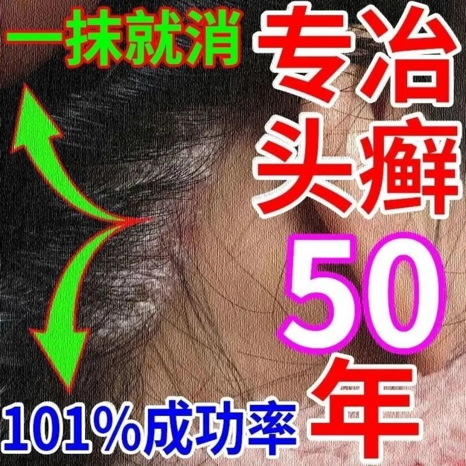 Tinea capitis, psoriasis, seborrheic dermatitis, scalp psoriasis ...