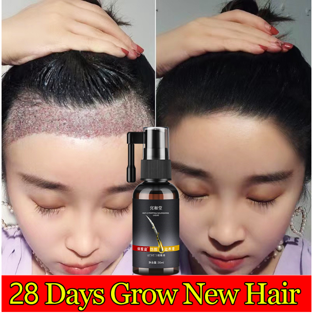 Hair Growth Serum 50ml Anti Hair Loss Preventiom For Men And Women Hair