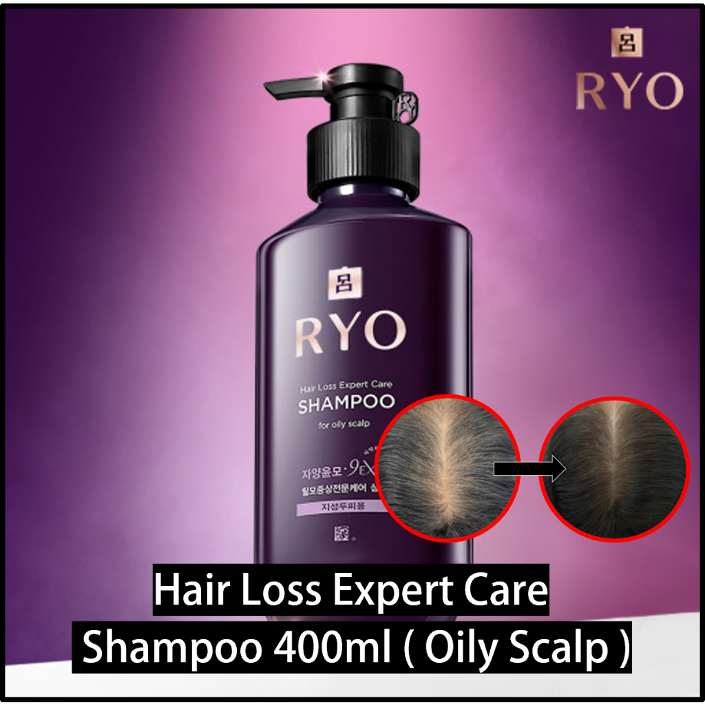 [ RYO ] Hair Loss Expert Care Shampoo 400ml ( Oily Scalp ) | Shopee ...