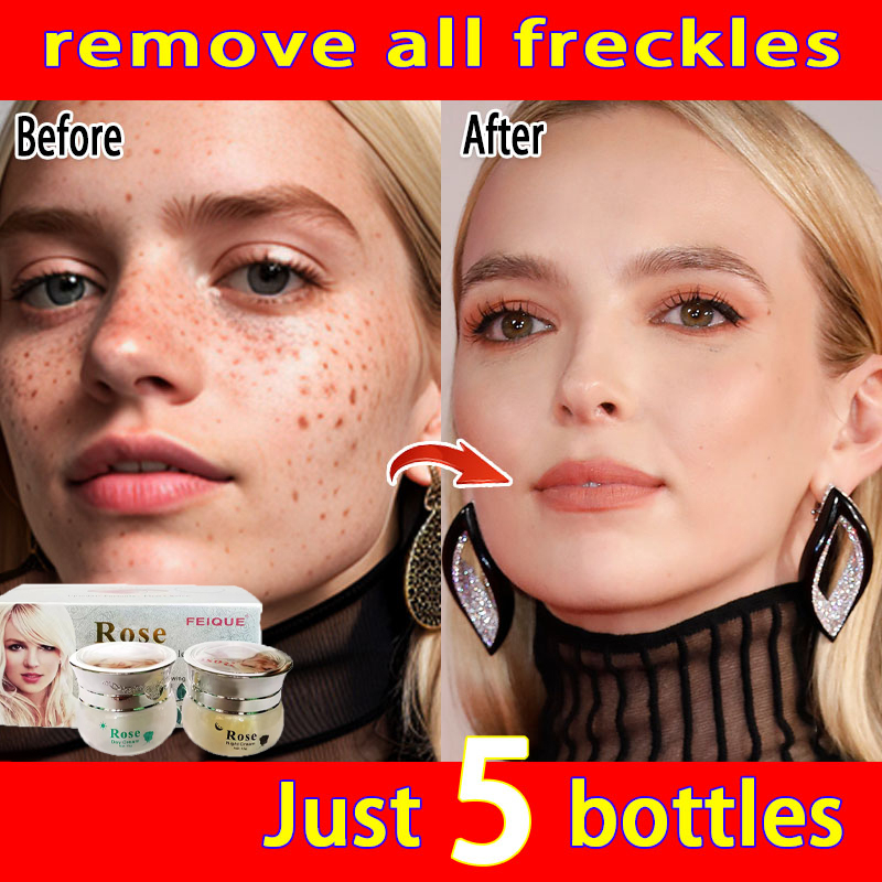 Spot Removal Essence Remove Facial Spots Skin Dark Spots Remove ...