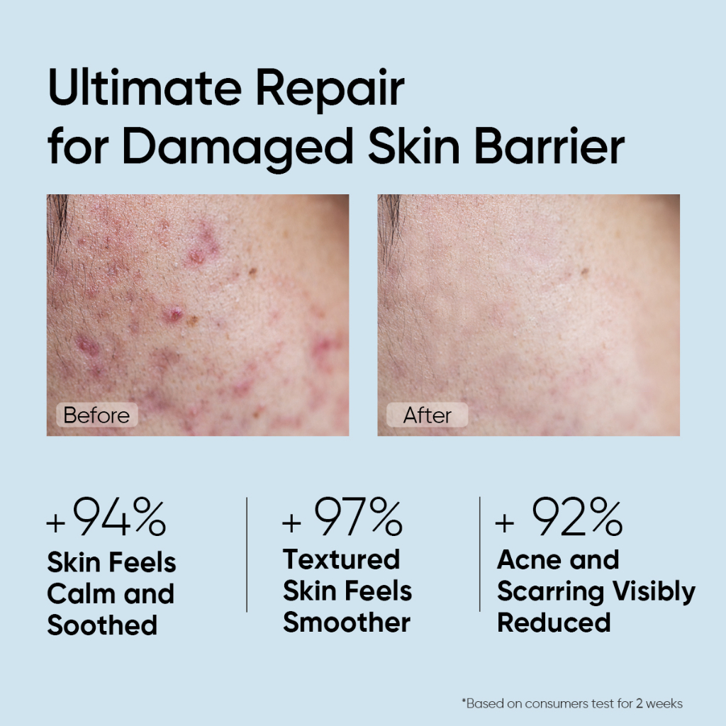 SKINTIFIC 5X Ceramide Barrier Serum 20ml - Repairs Skin Barrier ...