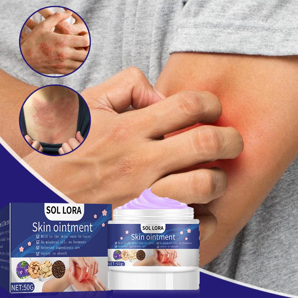 Effective Psoriasis Ointment Antibacterial Cream Herbal Antibacterial ...