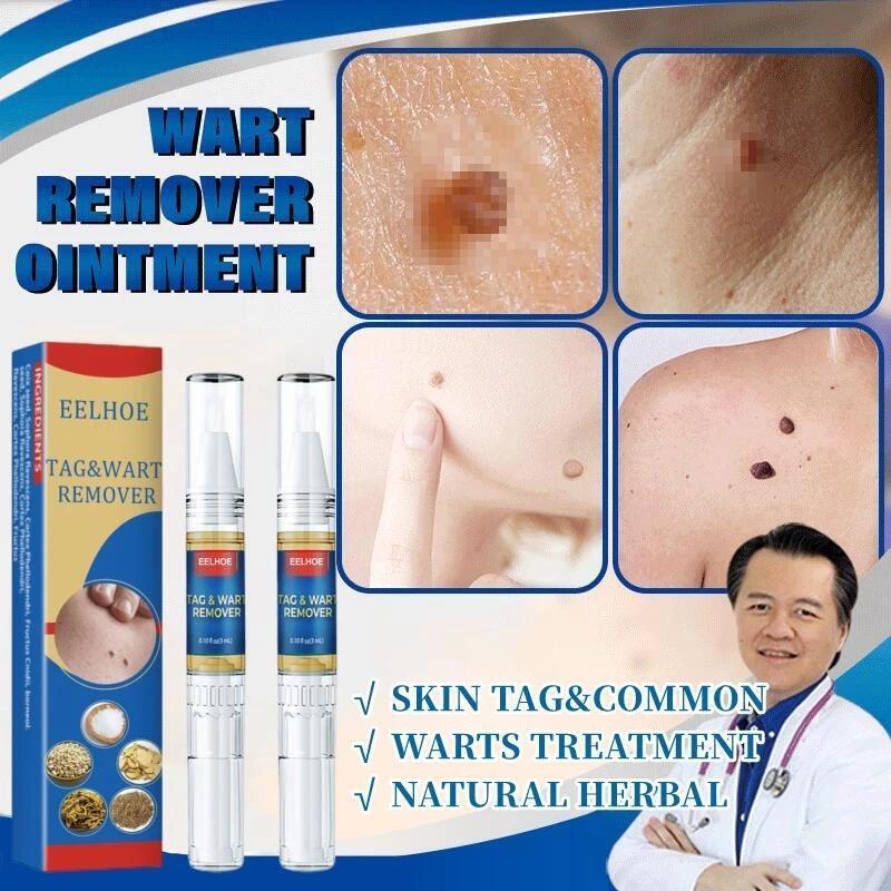 100% Effective Wart mole removal pen skin label removal liquid warts ...
