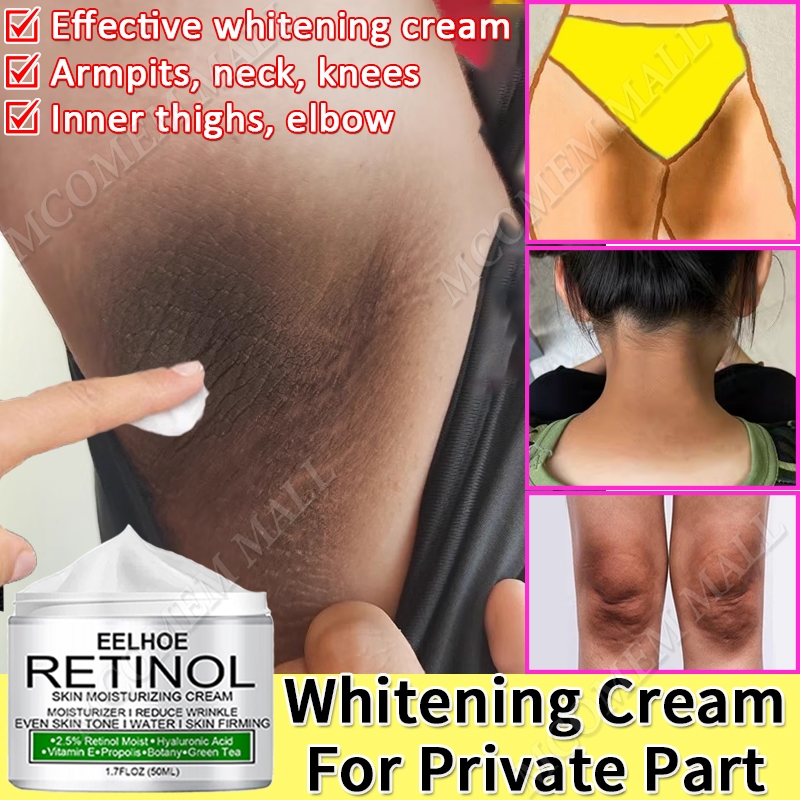 Whitening Cream Private Part Whitening Lotion Brightening Skin Armpit ...