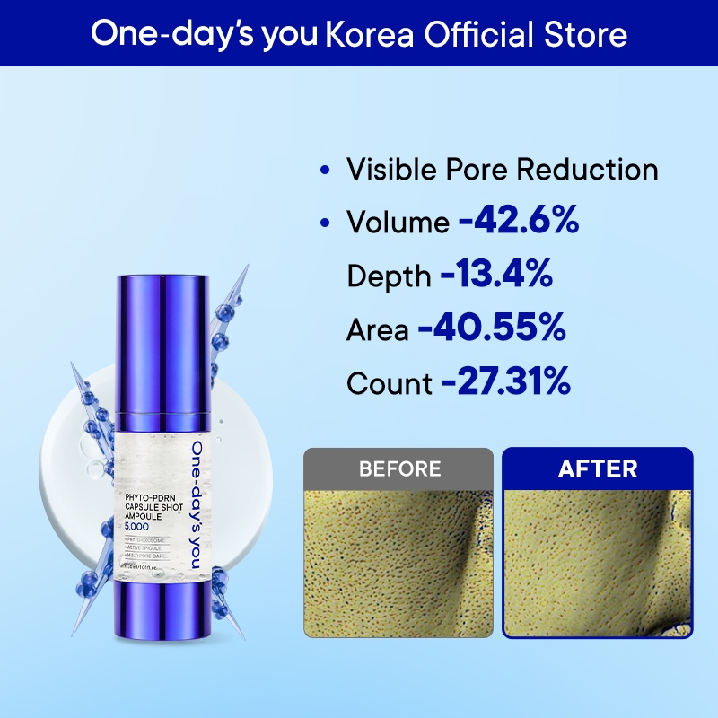 [ONE DAY'S YOU] PHYTO-PDRN Capsule Shot Ampoule 5000 30ml | Shopee ...