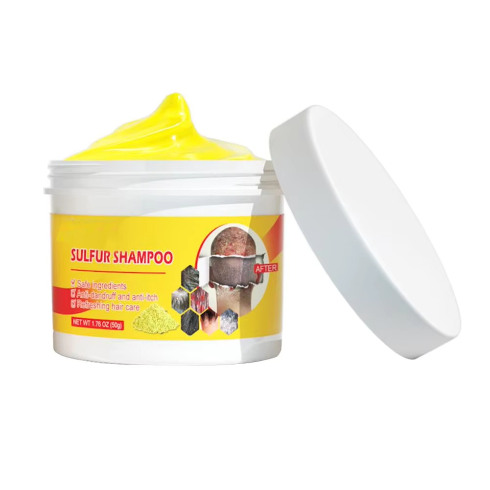 Hair Lice and Demodex Mites Removal - Sulfur Hair Treatment Mask 50ml ...