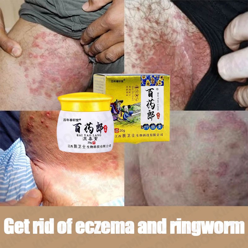 Eczema Cream Itchy Skin Cream Psoriasis Ringworm Rashes Herpes Mosquito ...