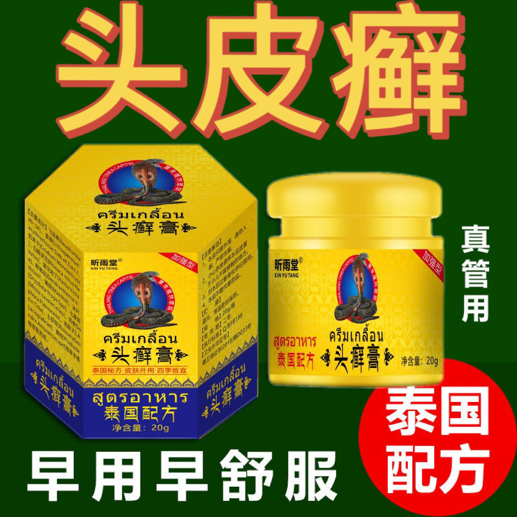 Tinea capitis scalp specific psoriasis scalp seborrheic dermatitis ...