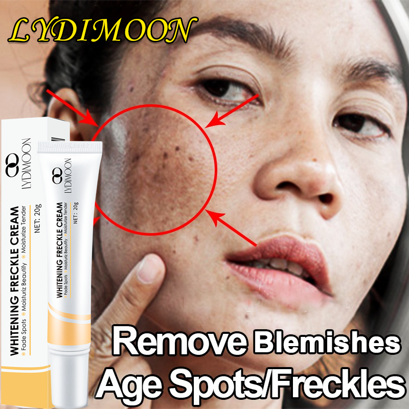 Freckles Removal Cream 20g Dark Spot Remover Whitening Freckle Cream ...