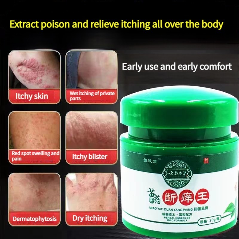 Yunnan herbal vaccine rapid antipruritic cream skin allergy systemic ...