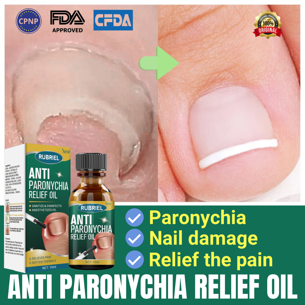 Anti Paronychia Relief Oil Fungal Infection Pain Relief Onychomycosis ...