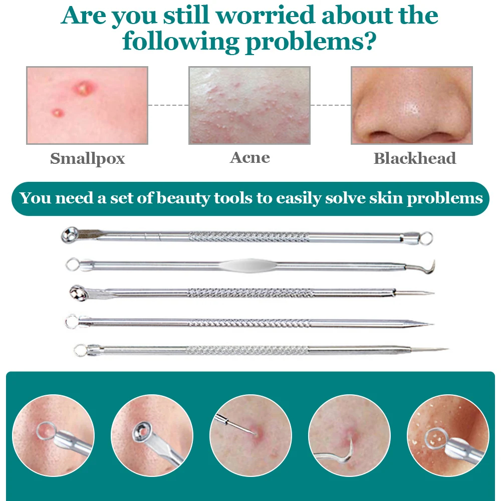 German Tech Ultra-fine No.5 Pimples Blackhead Clip Tweezers Beauty Face ...