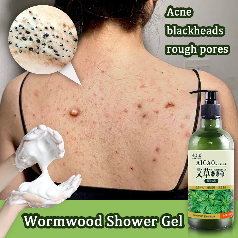 Wormwood Acne Body Wash 500ml Acne Treatment Mite Removal Aantipruritic Back Care Anti-mite ...