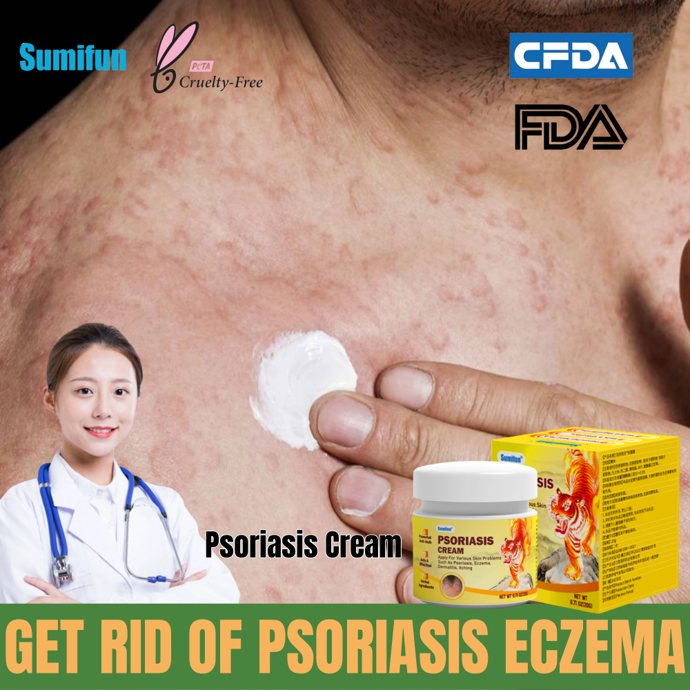 Psoriasis Cream Eczema Ointment Repair Dermatitis Ringworm Relief Dry ...