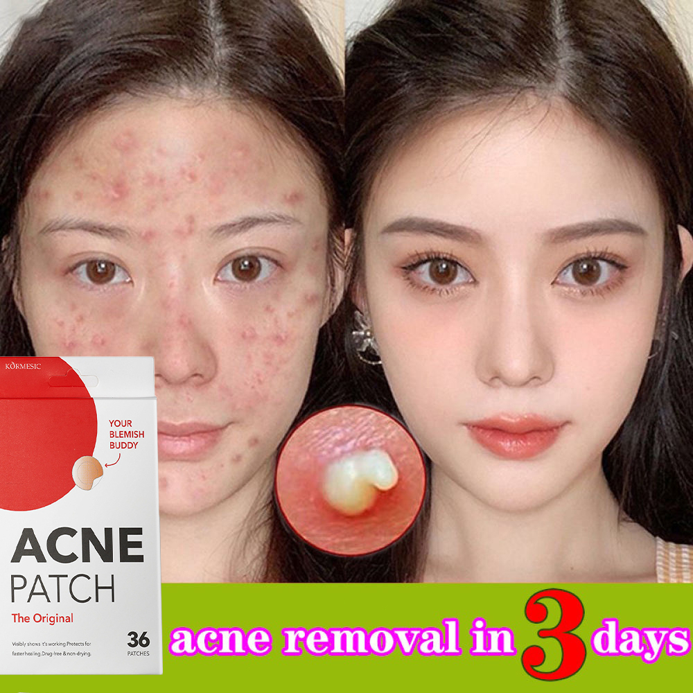 🔥36PC🔥Acne patch Acne Pimple Patch Invisible Spot Hydrocolloid Fast- Acting Deep Blemish Zit ...