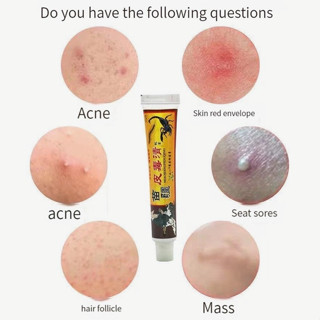 【🇸🇬Ready 】Fire boil draw poison draw pus redness relieve itching pimple ...