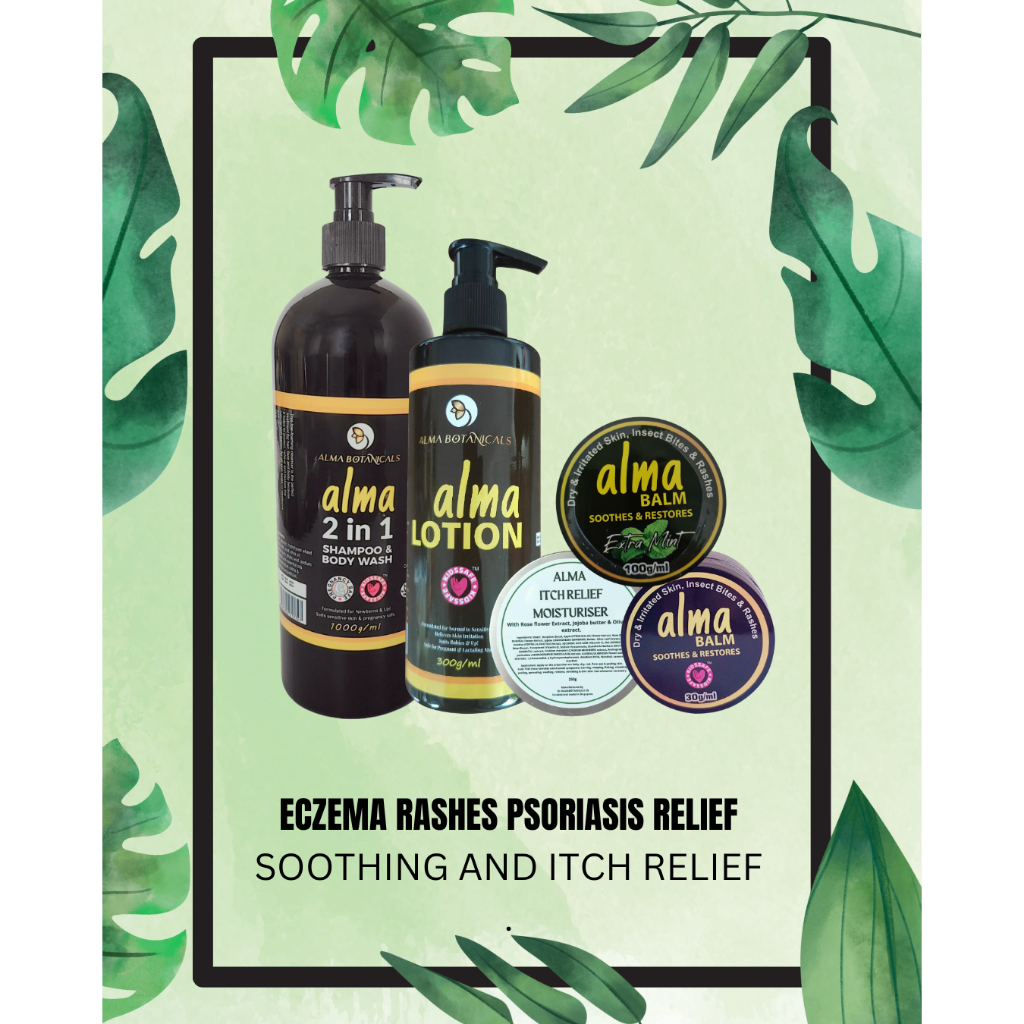 💚Buy 2 Get 1 Free💚SGS TESTED STEROIDS ECZEMA BABY ALMA BALM lotion ...