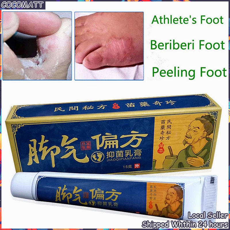 ️SG Stock ️Herbal Athlete'sFoot Cream Anti Fungal Relieve Beriberi ...