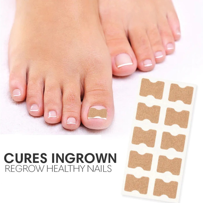 10pcs Ingrown Toenail Sticker Corrector Patch Toenails Nail Lifter Toe ...