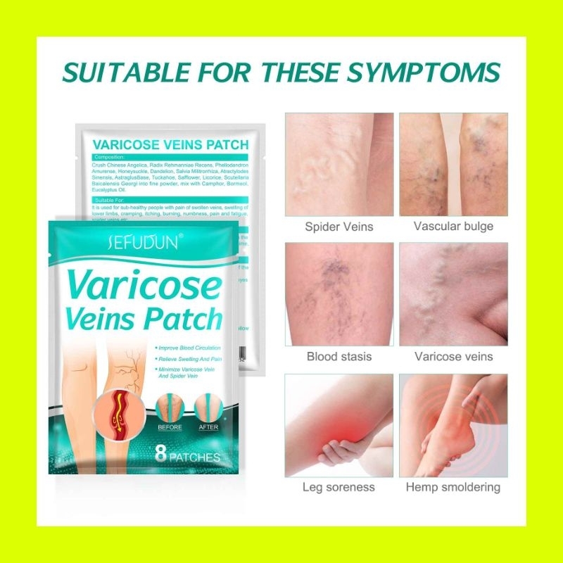 ♥️🇸🇬#1 Varicose veins patch, pain and swelling relief 8 patches per ...