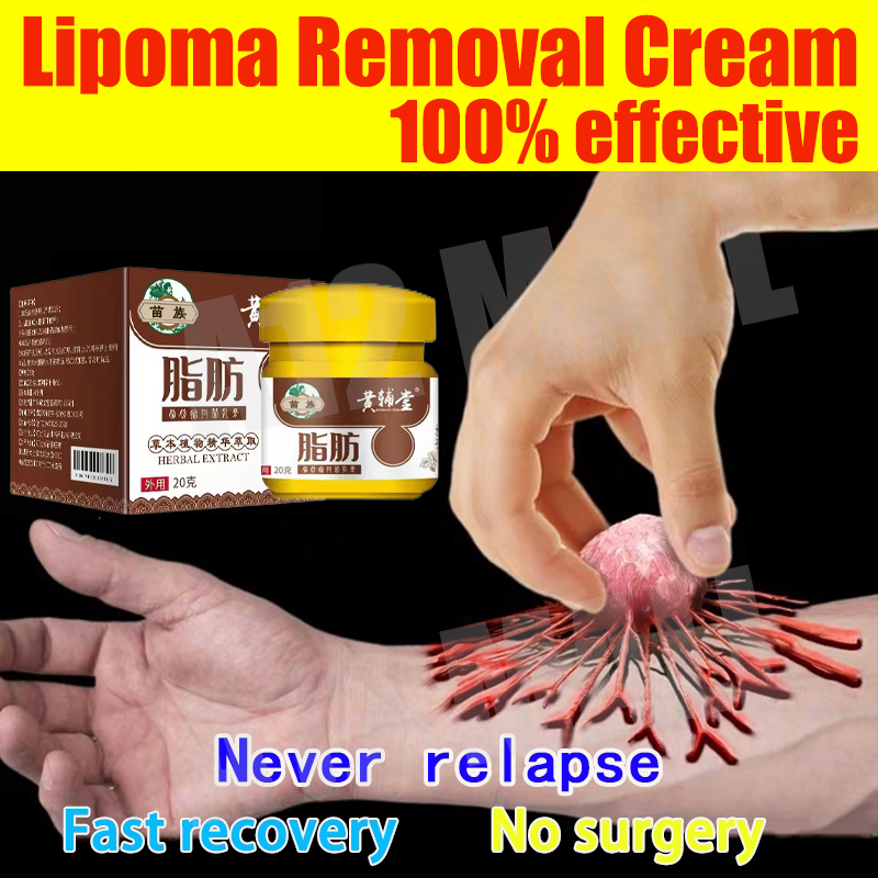 Lipoma Removal Cream Eliminate lipoma Lipolysis Fat Lump Relief Plaster ...