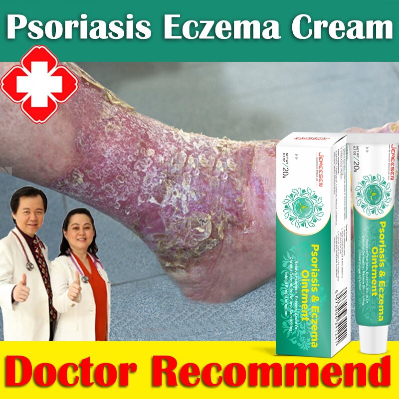 Jemeesen Psoriasis Ointment Eczema Cream For Itchy Skin Relief Gatal