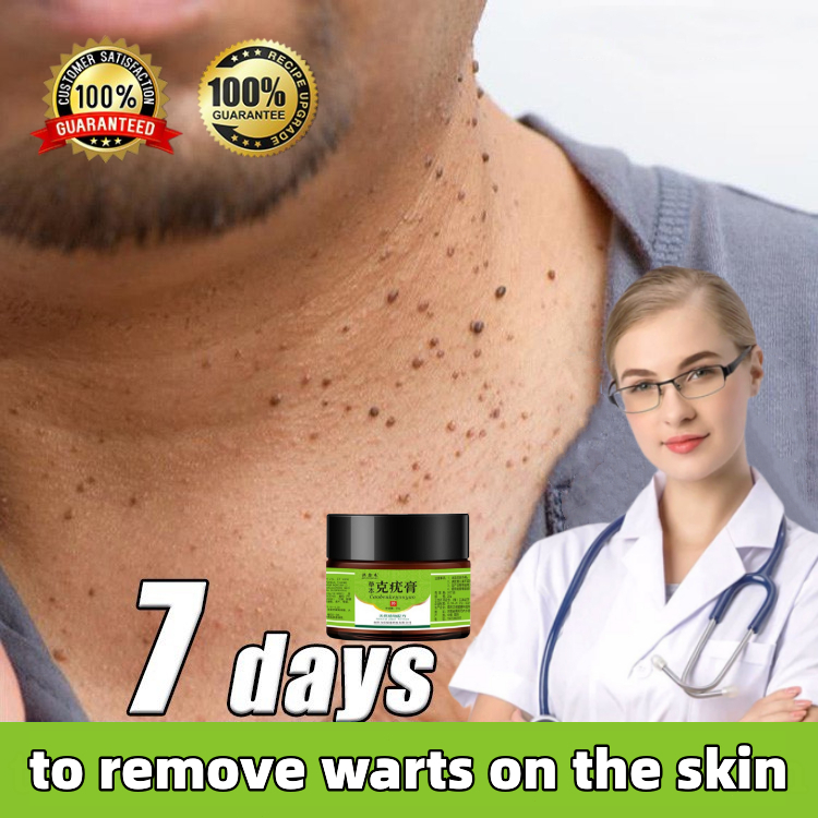 Wart Removal Cream Painless Ointment Papilloma Acne Mole 20g Mole and ...