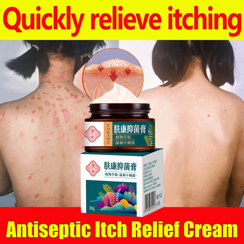 Eczema and antifungal cream herbal plant itchy skin cream psoriasis ...