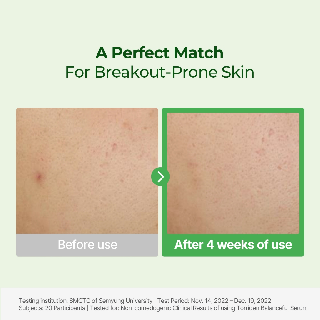 [Torriden Official] BALANCEFUL Cica Serum for Sebum and Dead Skin Cells ...