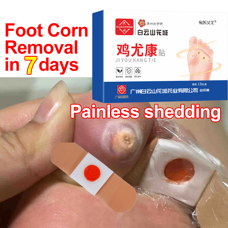 Foot Corn Removal Patch Warts Thorn Curative Callosity Detox Foot Pads ...