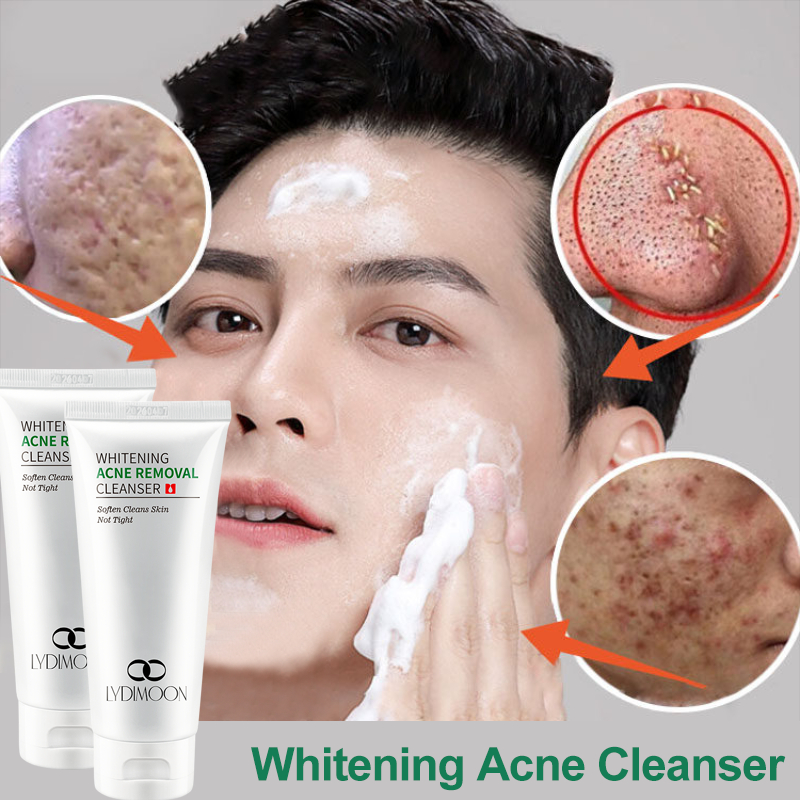 Whitening Facial Wash Acne Cleansing Foam, Hydrating Bubble Face Wash ...