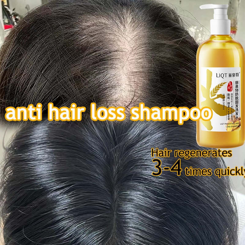 Shampoo Hair Loss Anti Hair Loss Shampoo Moisturize Hair Roots Remove Oil Refresh Ginger Care ...