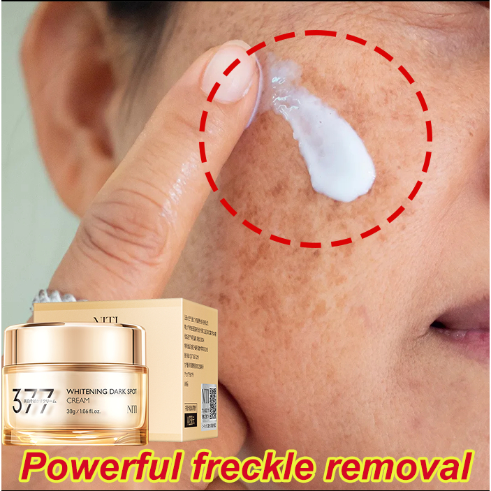 【New upgrade】377 Nicotinamide Whitening Freckle Remover Cream Whitening ...