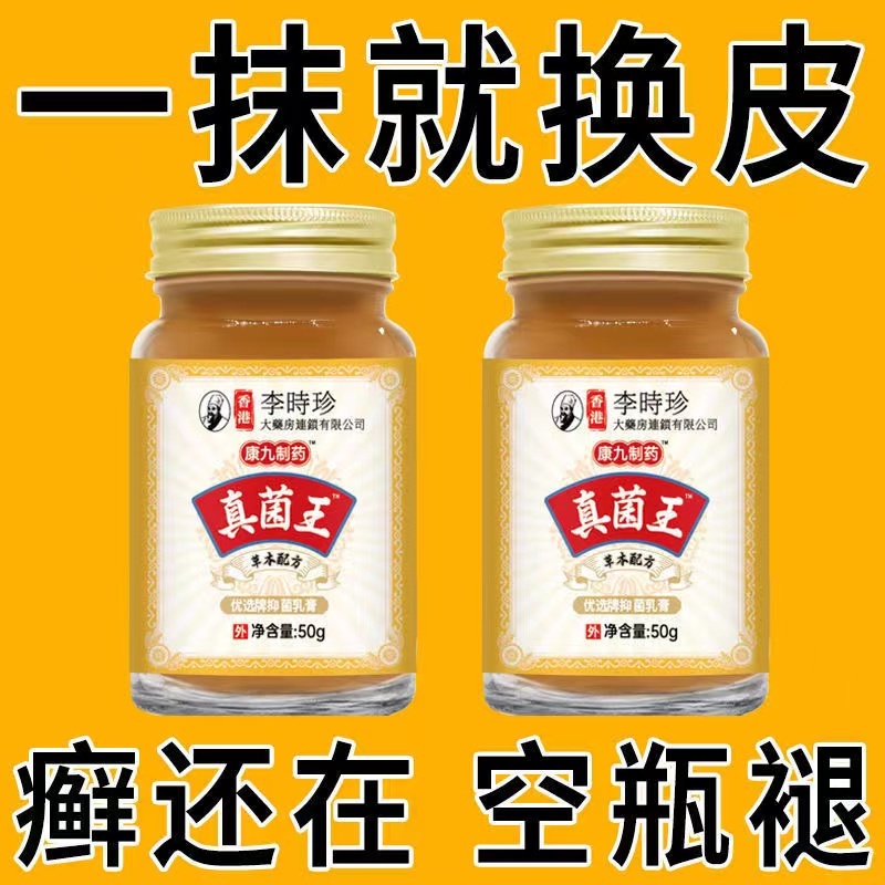 【Scalp Ringworm Nemesis】 Tinea capitis, dandruff, itchy scalp, itchy ...