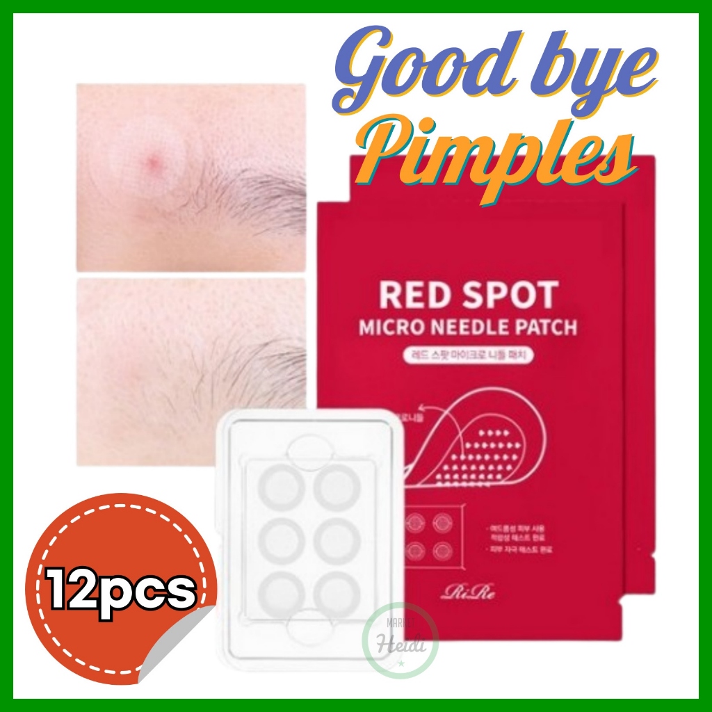 KOREA 🇰🇷 RIRE Red Spot Microneedle Pimple Patch / pimple patch with ...