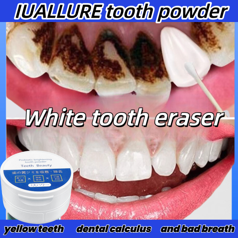 IUALLURE teeth whitening tartar remover 50g whitening teeth smoking ...