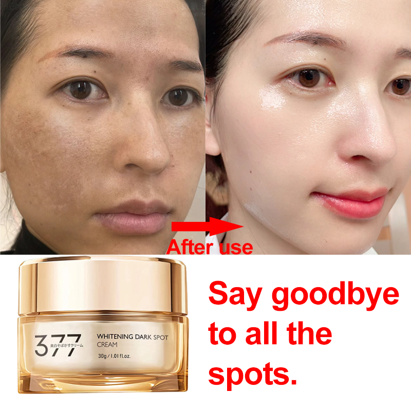 Whitening dark spot remover cream 377 Nicotinamide Freckle Remover ...