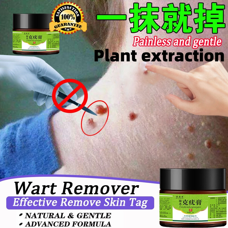 【SG Local sellers】Skin Tags Remover Warts Removal 20g Antibacterial ...