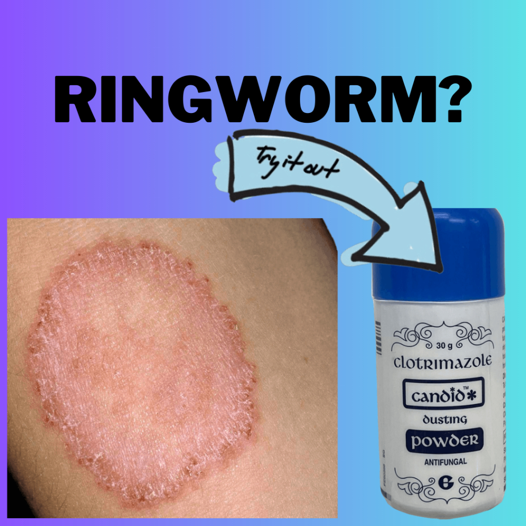 Antifungal Powder Anti Fungal Ringworm White Spot and Athletes Foot ...