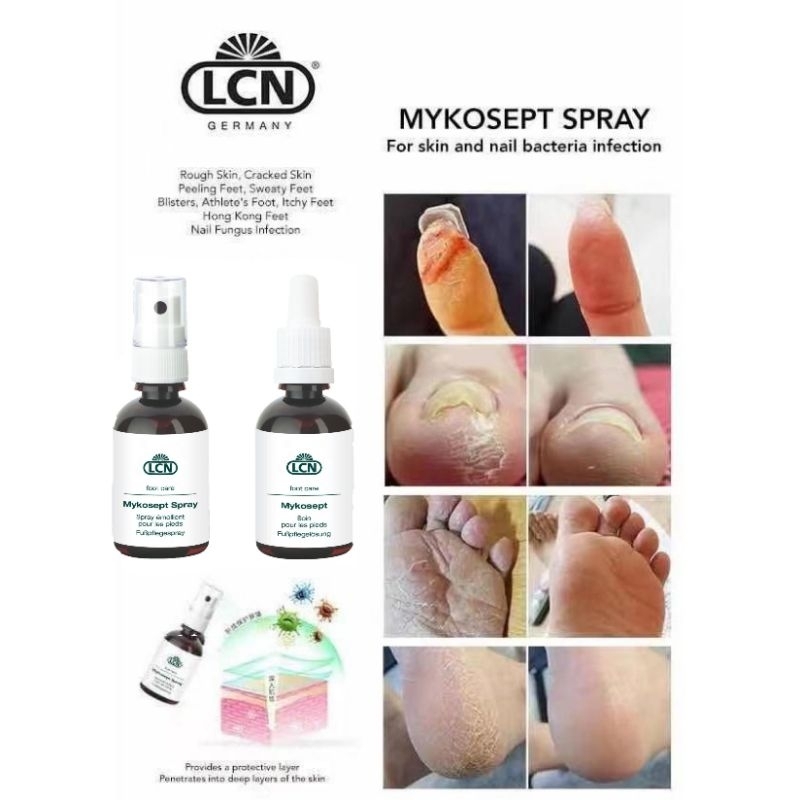 LCN Mykosept Spray/Dropper Fungus Treatment 50ml | Shopee Singapore